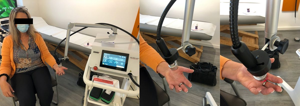 Polyarticular arthritis of both hands