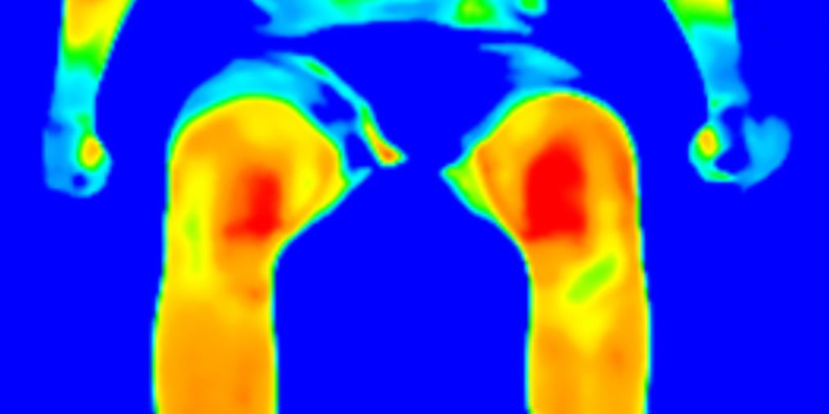 Infrarotthermografie